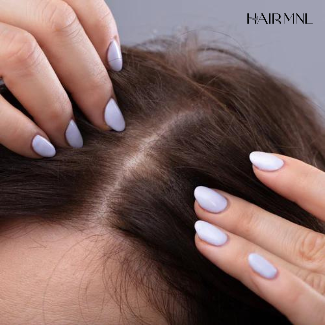 Hair Fall Woes - Why It Happens and How to Manage It - HairMNL