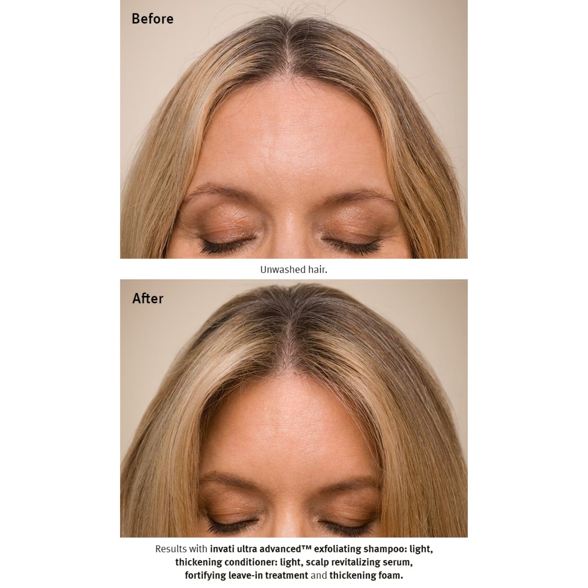 Aveda_Invati_Ultra_Advanced_Light_Before-After_2.jpg?v=1723939727